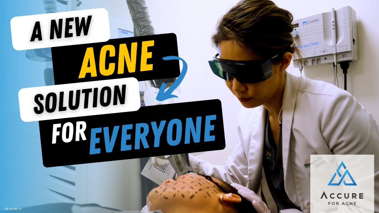 The Accure Laser Works On All Skin Types - YouTube