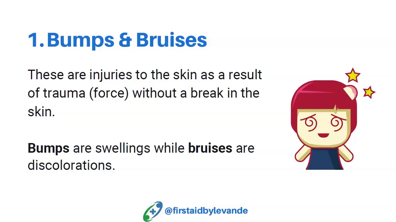 First Aid for Bumps and Bruises - YouTube