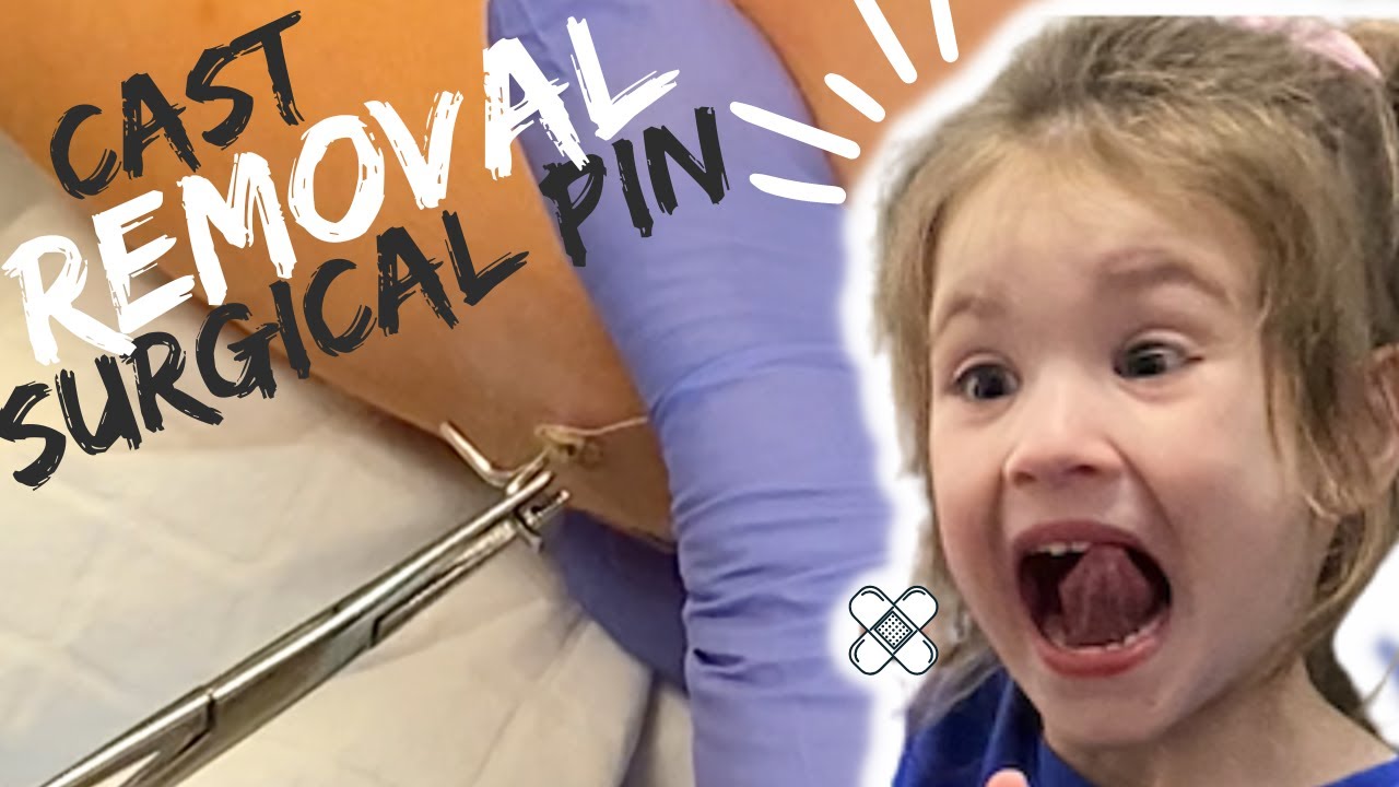 Ev's Gets Cast and Surgical Pins Removed After Broken Arm - YouTube