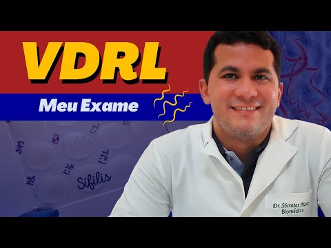 VDRL │ TESTE DE TRIAGEM PARA SÍFILIS │ MEU EXAME