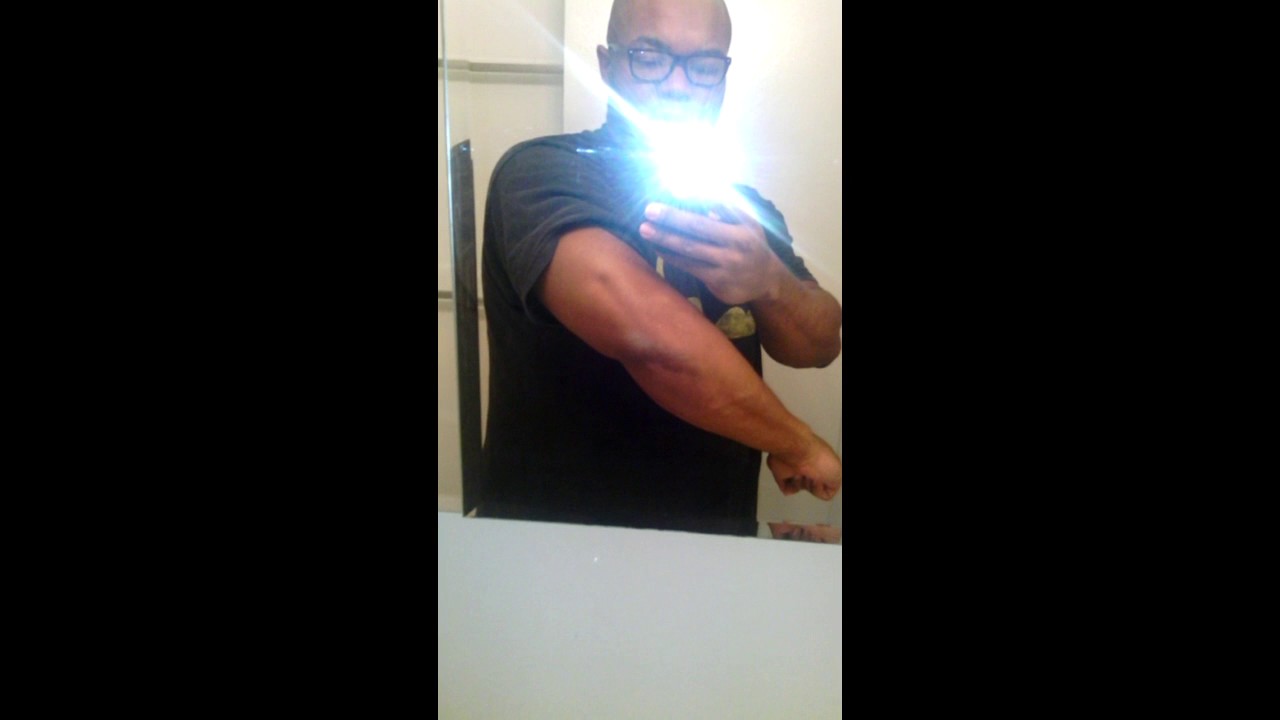 Worst Tricep Cramp Muscle Spasm Aftermath of Dan Jon 10,000 Swing ...