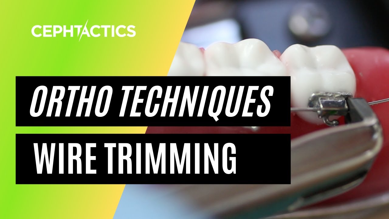Wire Trimming in Orthodontics - YouTube