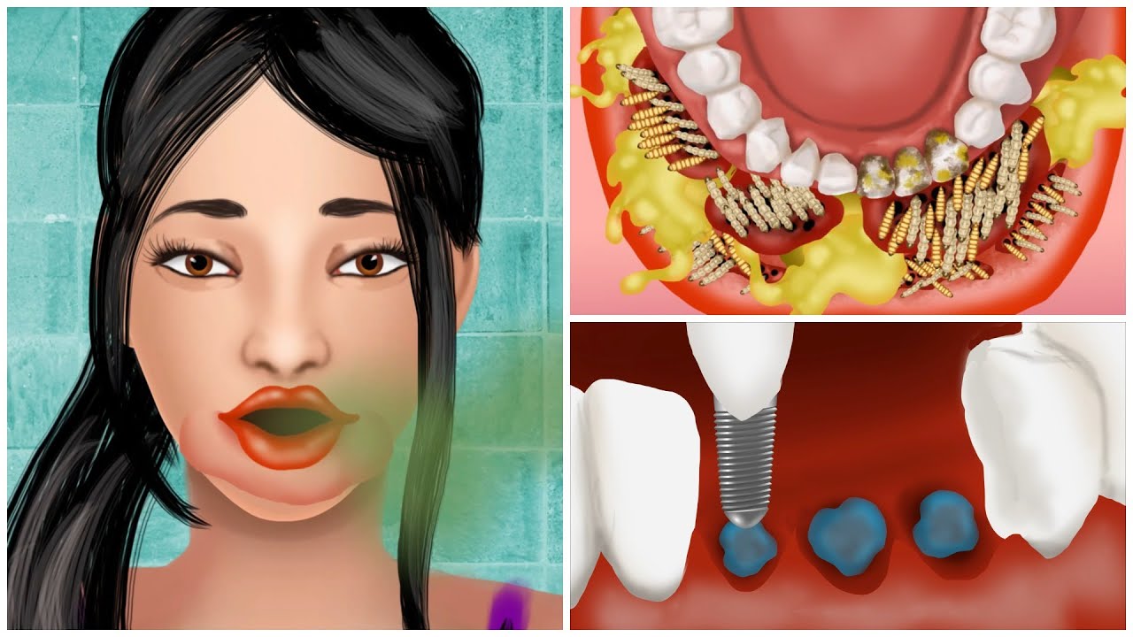 ASMR Treatment and satisfying animation of removing Worm & Maggot in ...