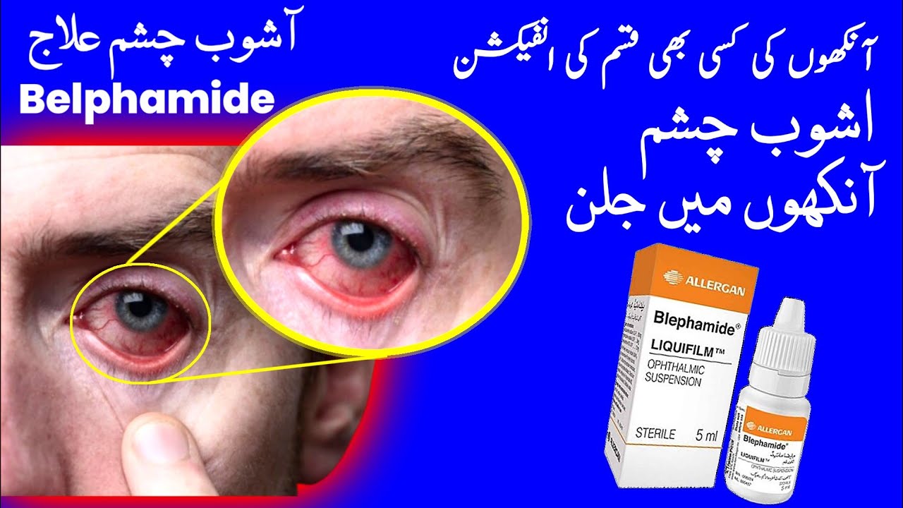 blephamide eye drop 👁️ || uses || side effects || opthalmology - YouTube