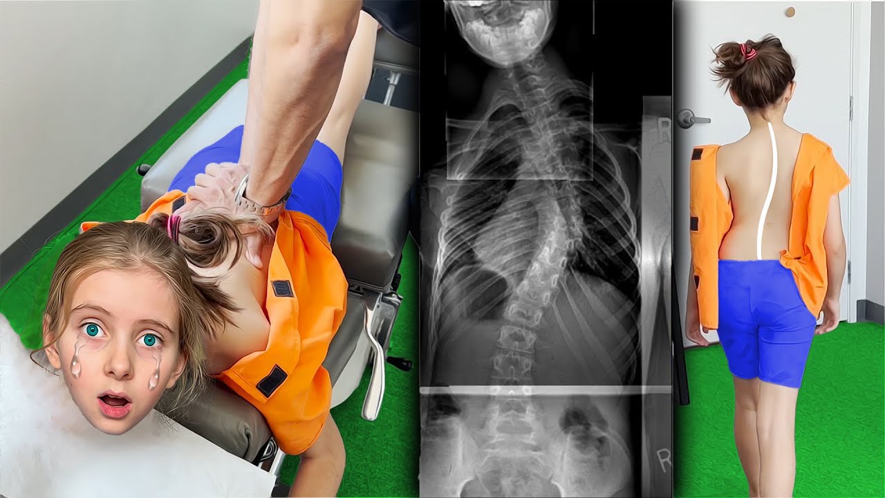 🔴 SCOLIOZA 🚨 Consultul MEDICULUI ORTOPED 💉 Primele EXERCIȚII pentru ...