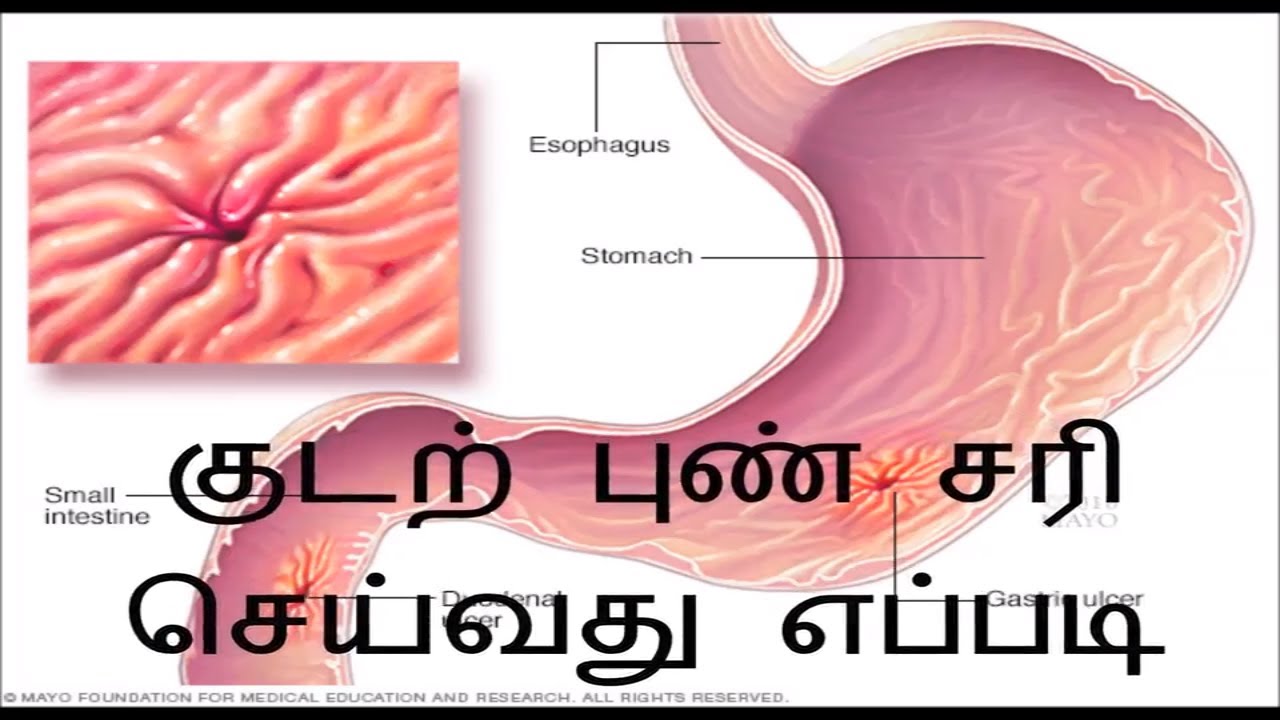 3 How To Cure Stomach Wound And 3-how-to-cure-stomach-wound-and