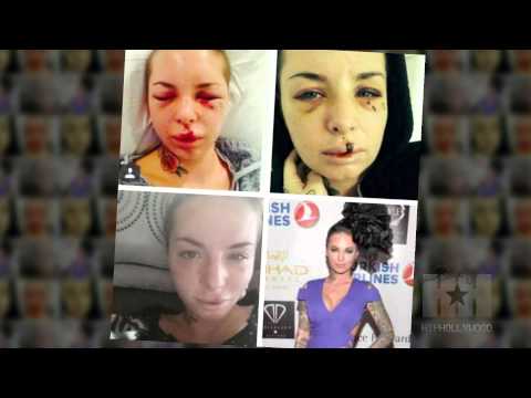 First Look at Christy Mack Since Vicious Assault - HipHollywood.com