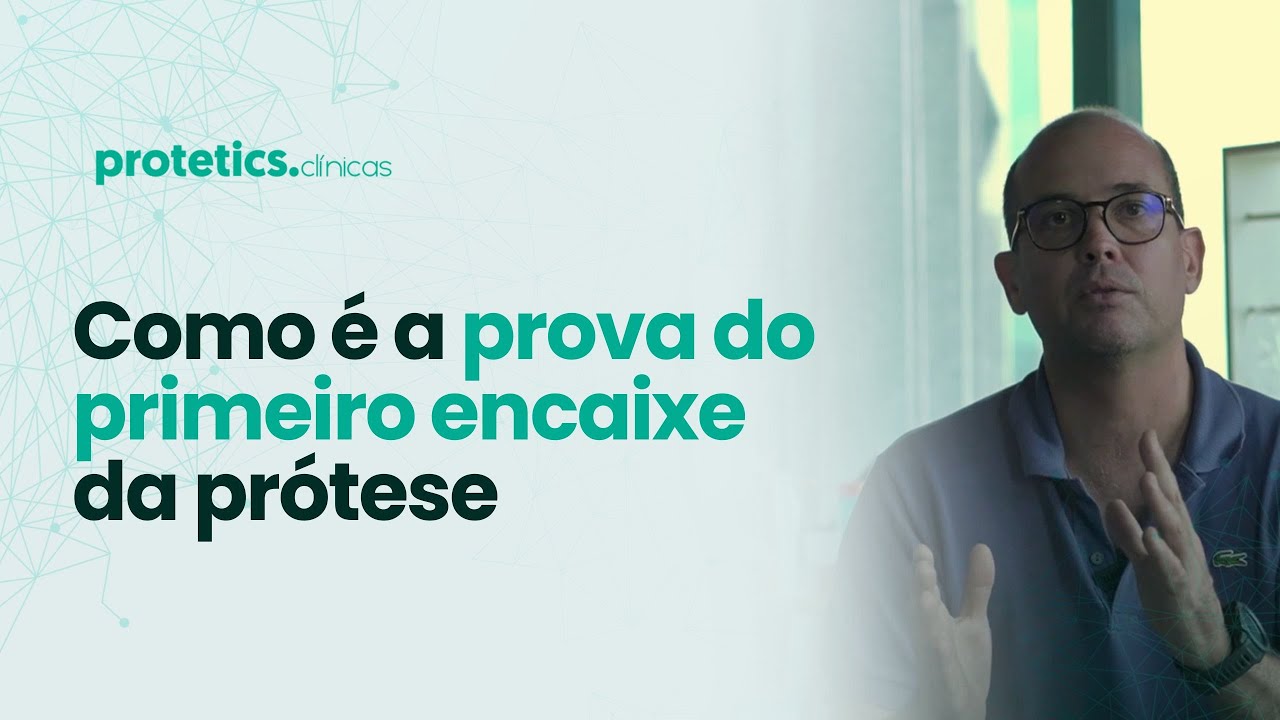 Encaixe Provisório X Encaixe Definitivo: Qual A Diferença? – ZHERSS