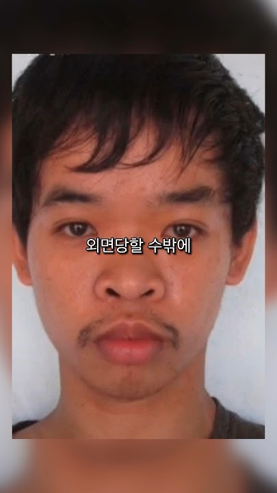 꿈을 위해 성형수술을 받고 대박이 난 남성ㄷㄷ Youtube