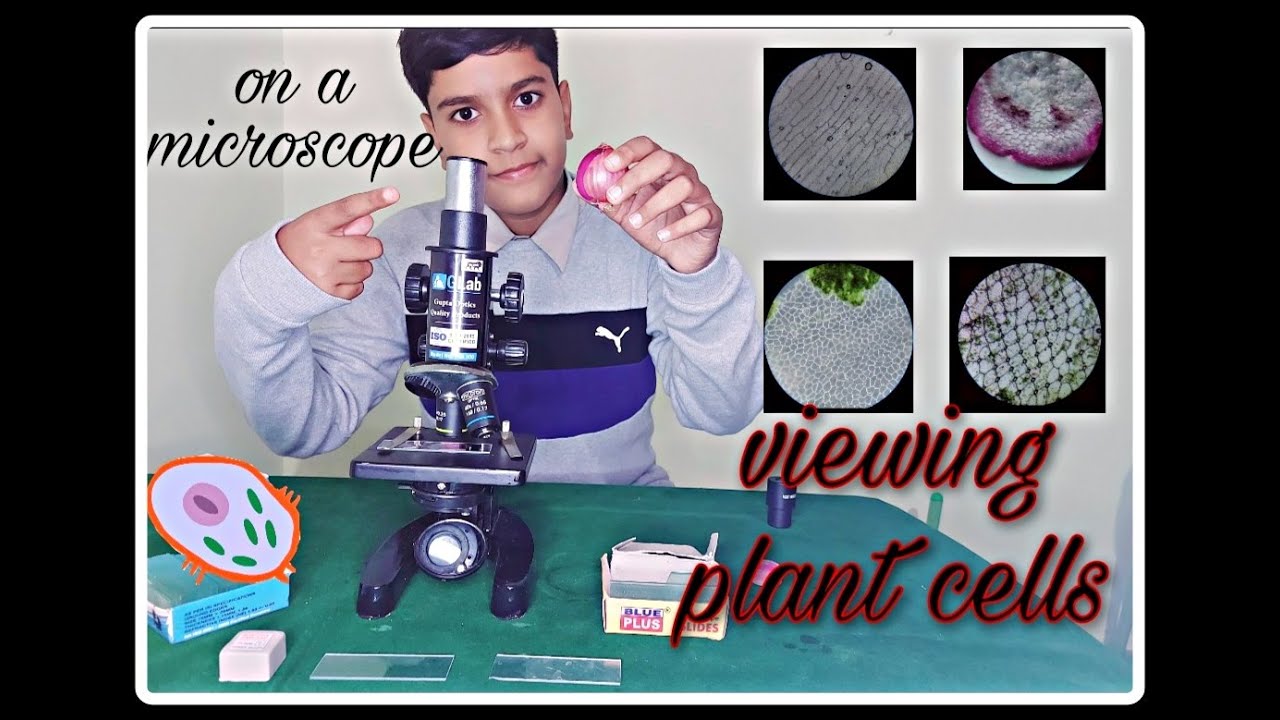 How To Prepare a Onion cell Slide? Viewing Many Different Leaf Cells on ...
