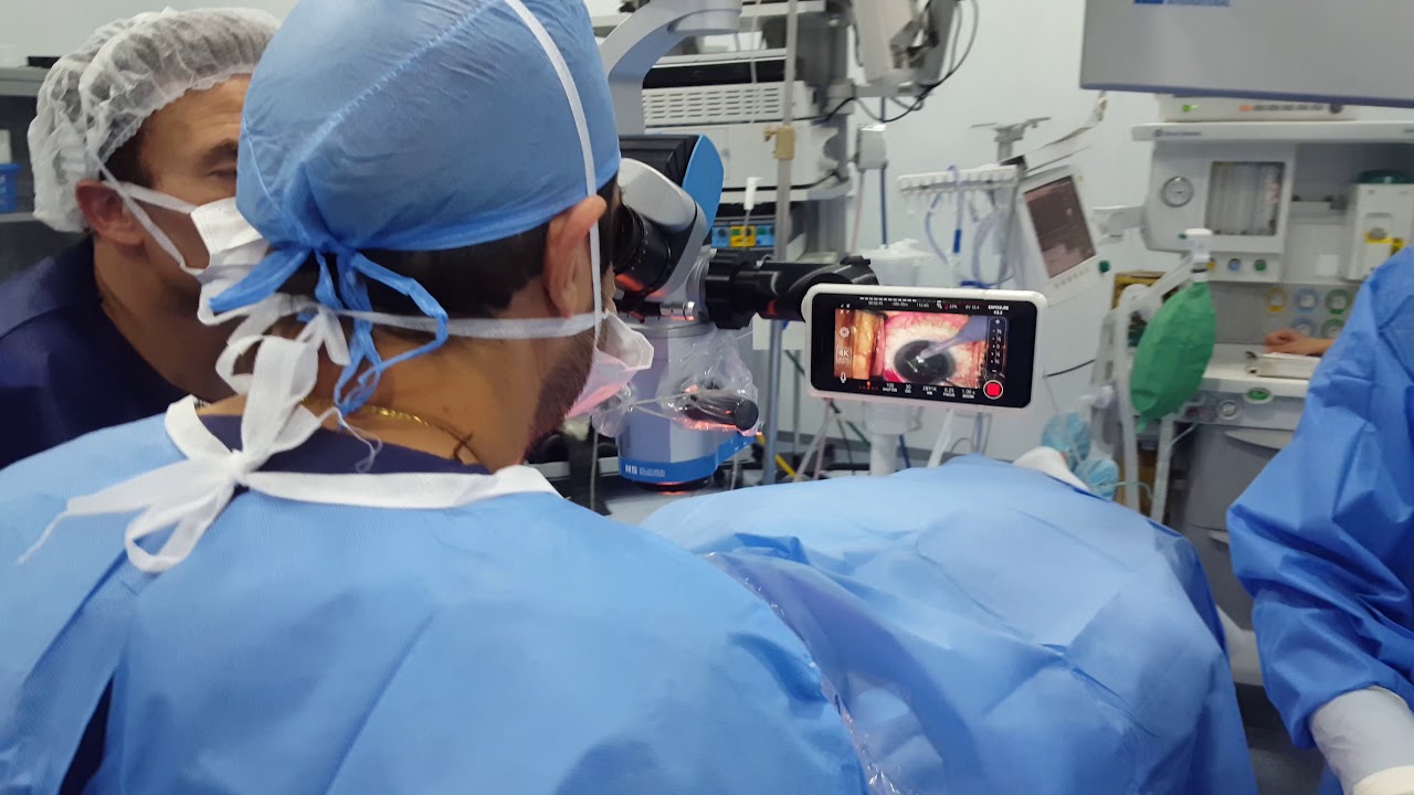 MicroREC first surgery recording - YouTube