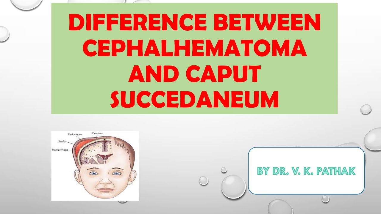 Caput Succedaneum Vs Cephalohematoma Why Does My Baby's Head Look