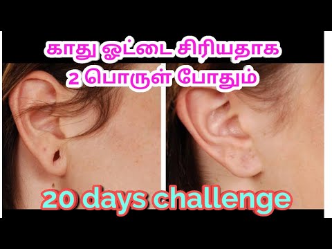How to reduce ear hole size naturally at home / big size ear hole /ear ...