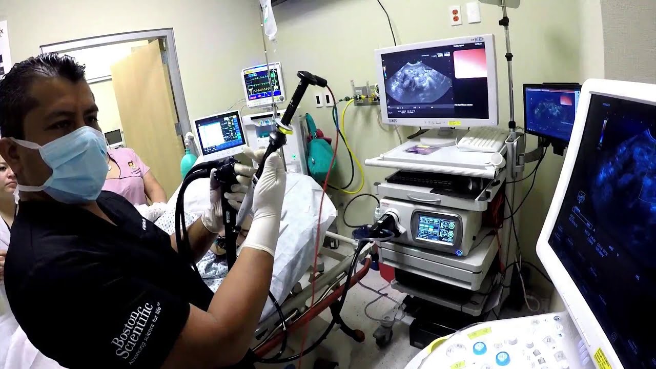 Hot AXIOS Step by Step HD 2019. deployment for pseudocyst drainage ...