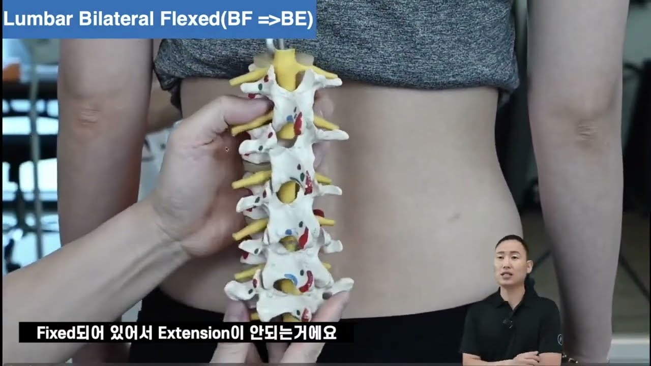 시골물리치료사의 요추이야기 17 요통 허리가 안펴지는 고객님 움직임분석 가동성검사 촉진 가동술 Youtube