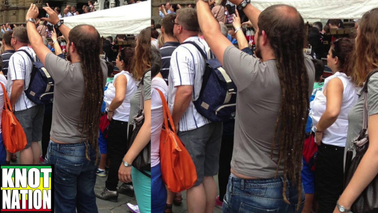 The Balding Spot Dreadlocks - YouTube