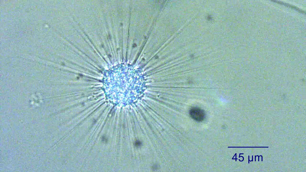 actinophrys sol - YouTube