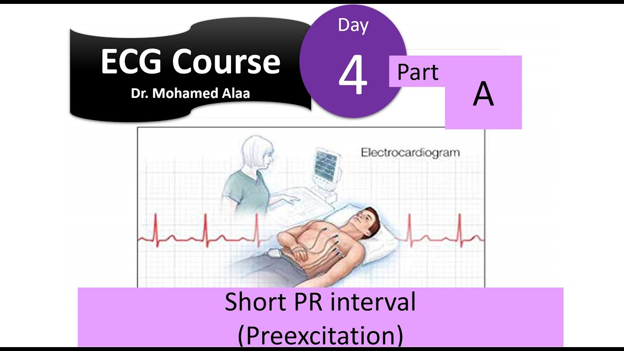 ECG course; Day (4); Part (A): Short PR interval, preexcitation - YouTube