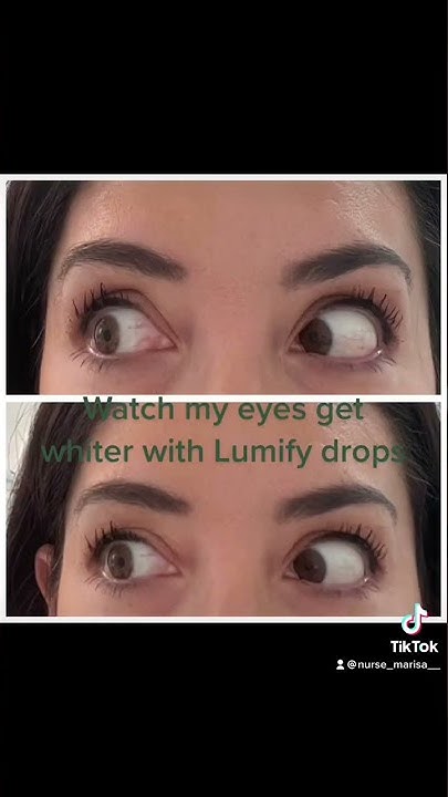 Watch my eyes get whiter with Lumify drops - YouTube