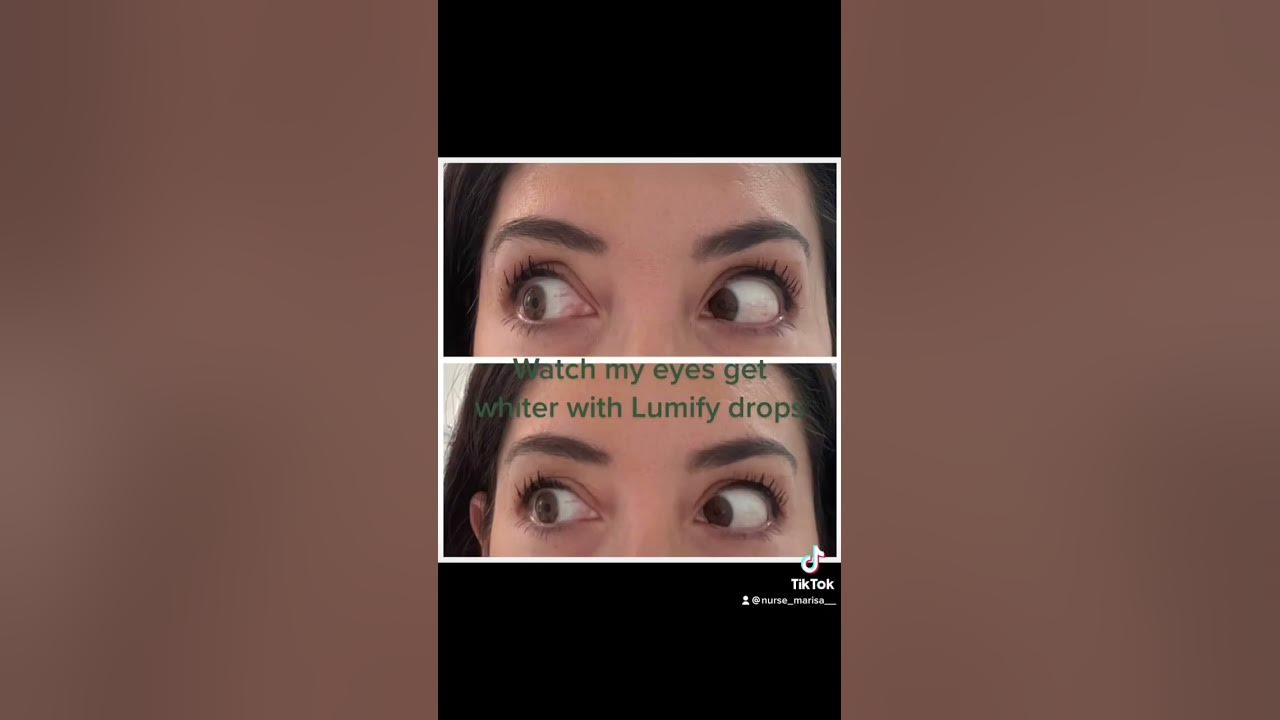 Watch my eyes get whiter with Lumify drops - YouTube