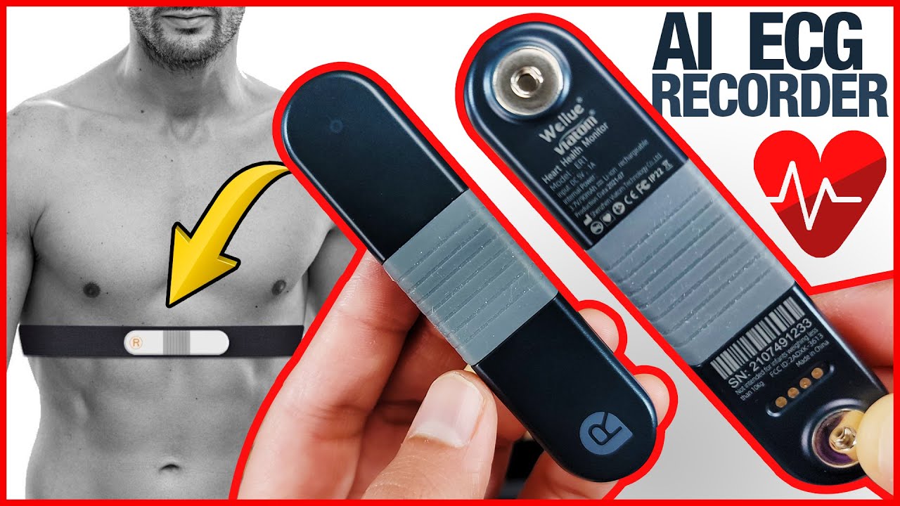 ECG Recorder with AI Analysis by Wellue! - YouTube