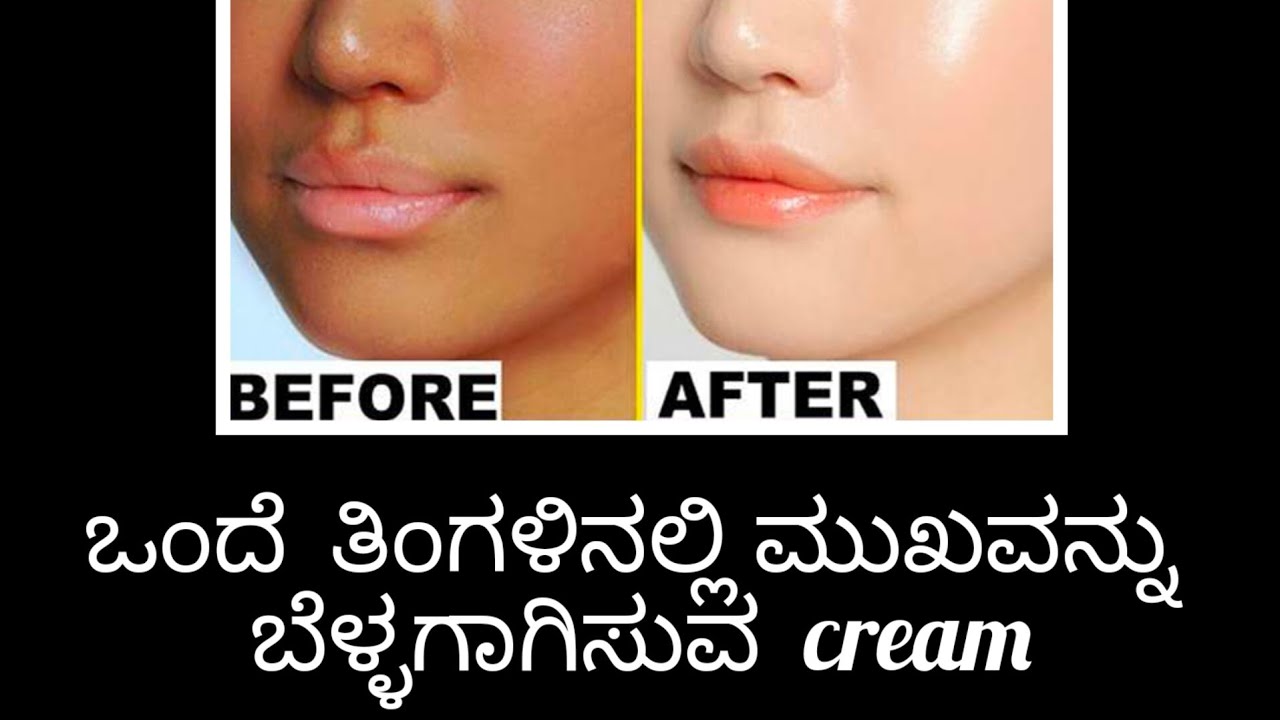 Glamus Cream Review In Kannada|| Skin whitening|| - YouTube