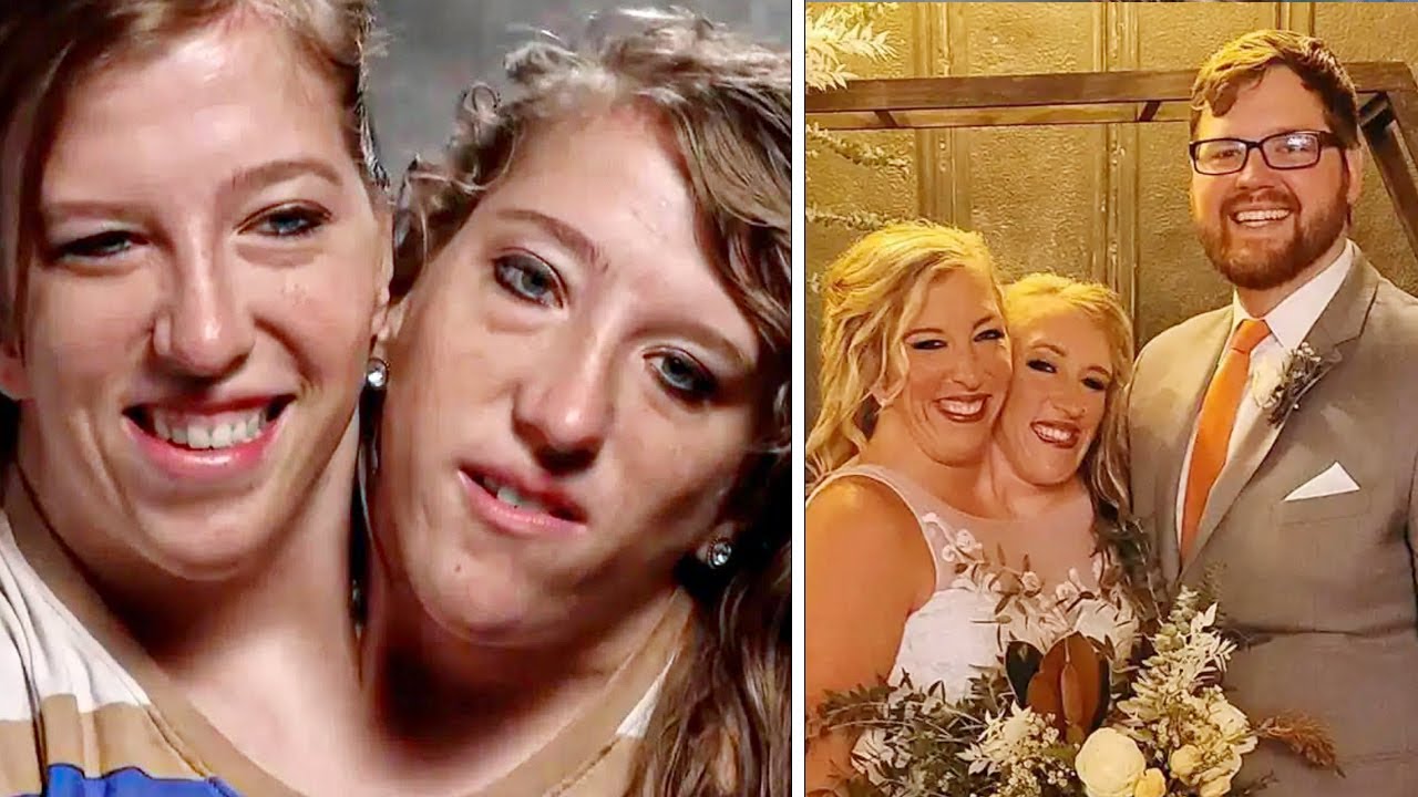 Las gemelas siamesas Abby y Brittany Hensel se casan y sorprenden a ...