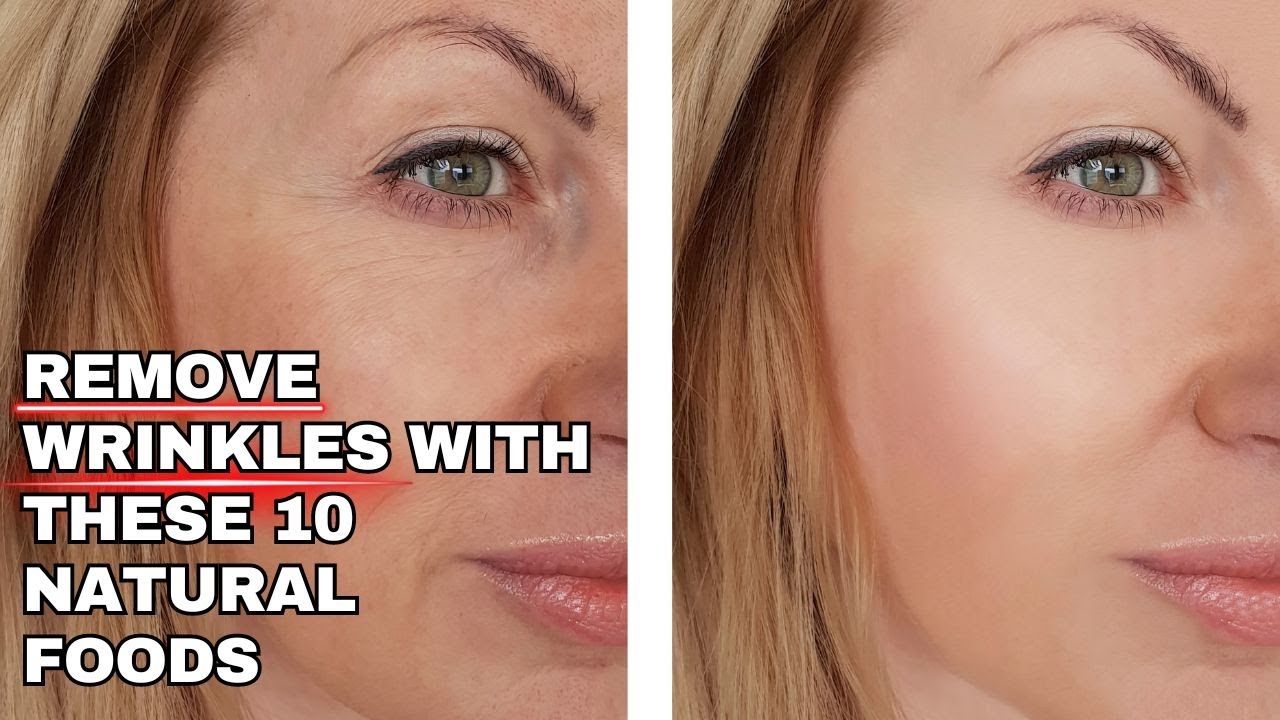 Remove Wrinkles with These 10 Natural Foods - YouTube