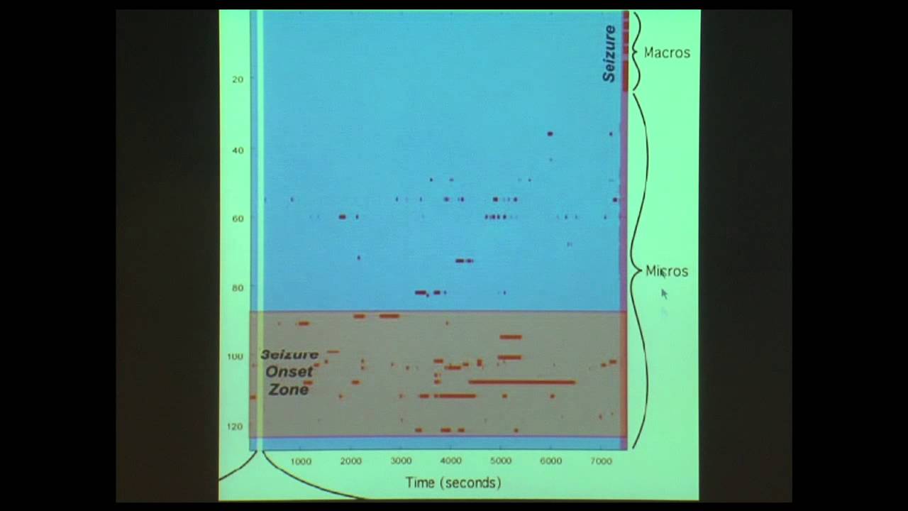 Professor Brian Litt - Flexible, Active Brain-Computer Interfaces for ...