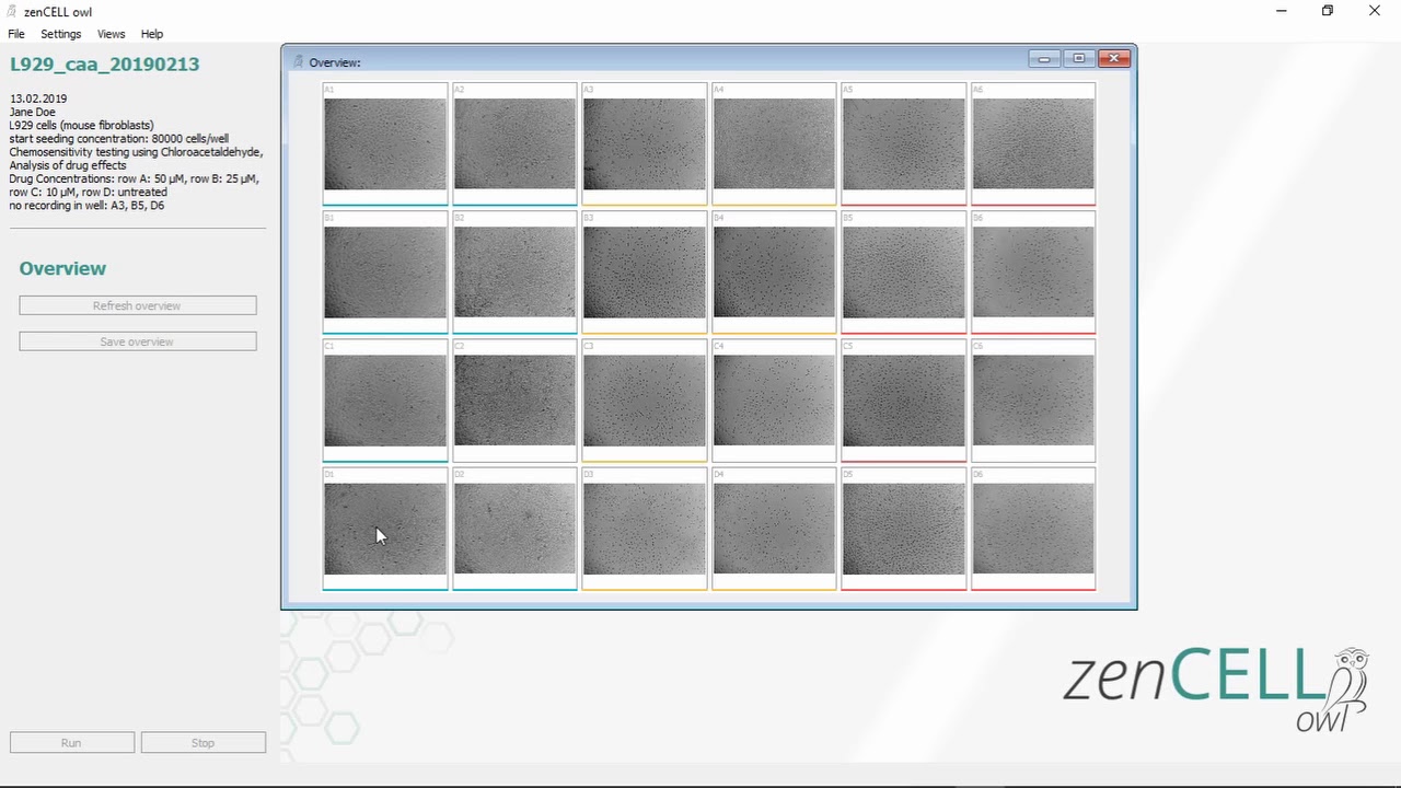 How to use the zenCELL owl | #livecellimaging - YouTube