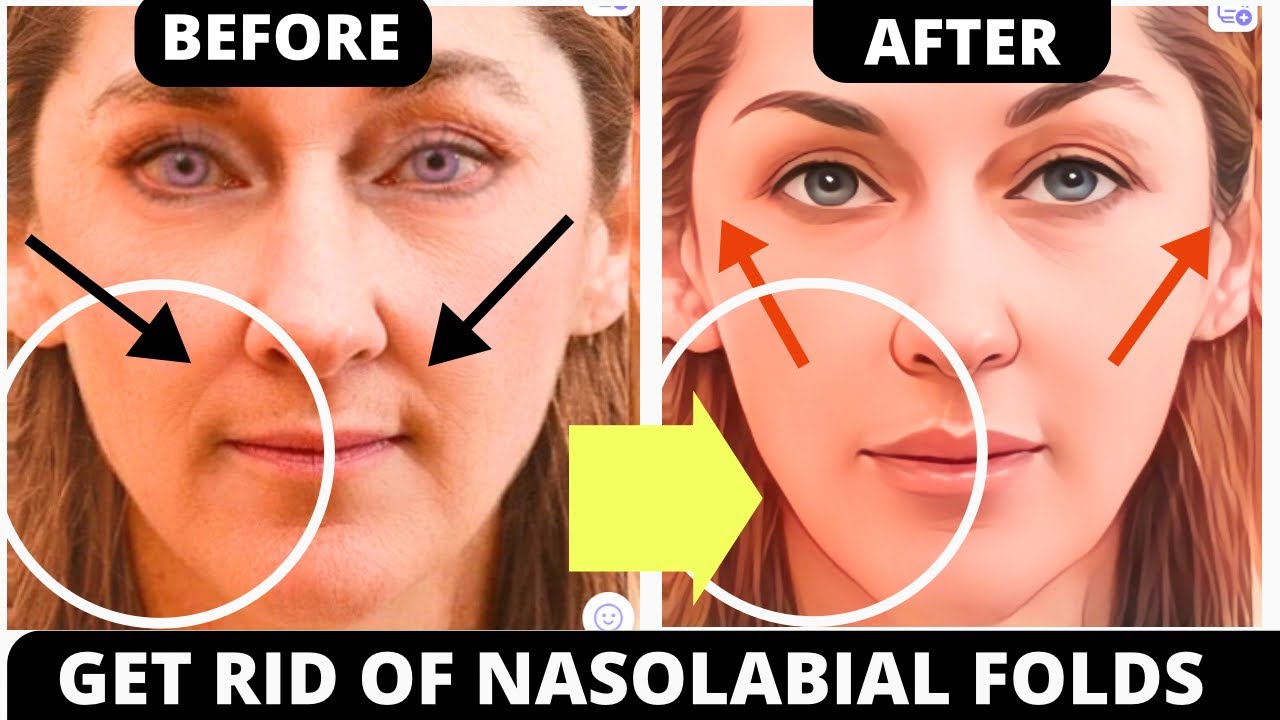 TOP FACE LIFTING EXERCISES FOR NASOLABIAL FOLDS, JOWLS, SAGGY SKIN ...