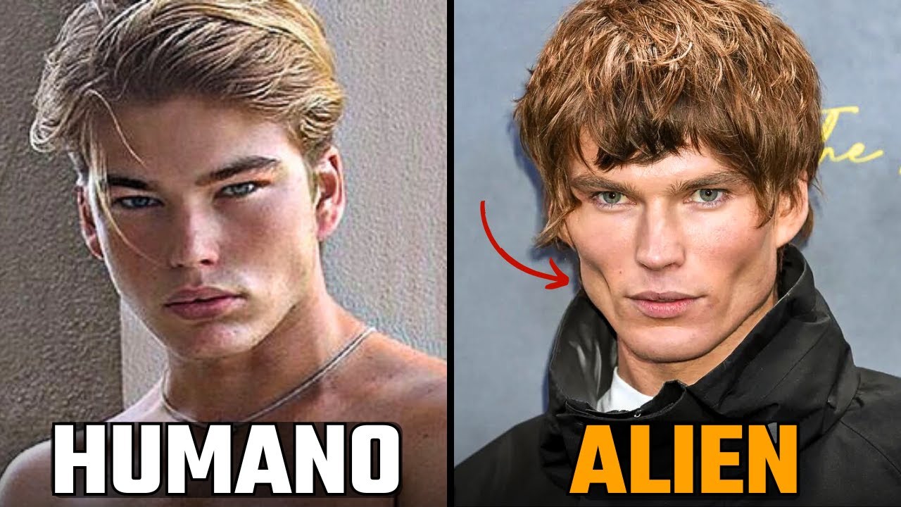 Como Jordan Barrett DESTRUIU o seu ROSTO com Cirurgia Plástica - YouTube