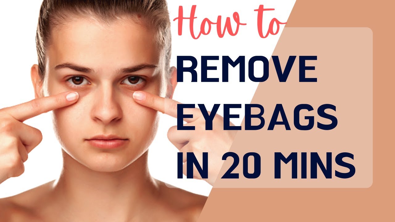 Get Rid Of Bags Under Eyes Quickly YouTube get-rid-of-bags-under-eyes-quickly-youtube
