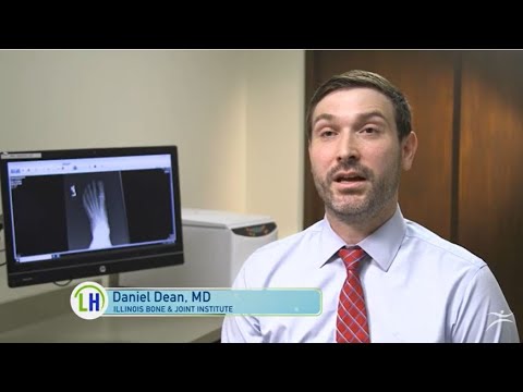 Ankle Injuries on WGN with IBJI's Daniel Dean, MD - YouTube