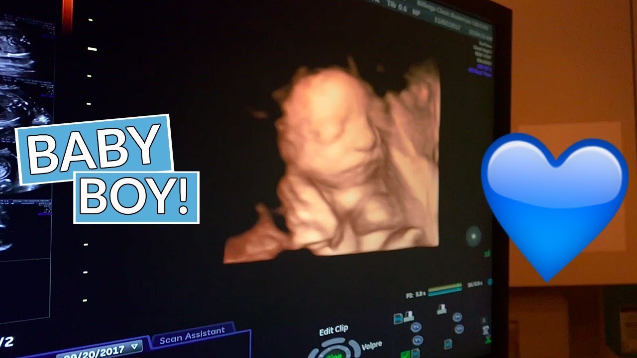 26 WEEK ULTRASOUND! - YouTube