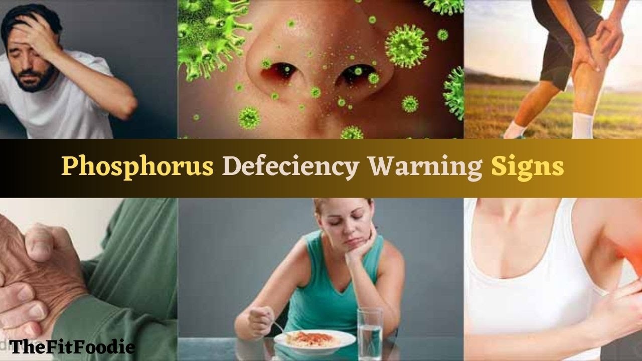 10 Warning Signs Your Body Is Need of Phosphorus - YouTube