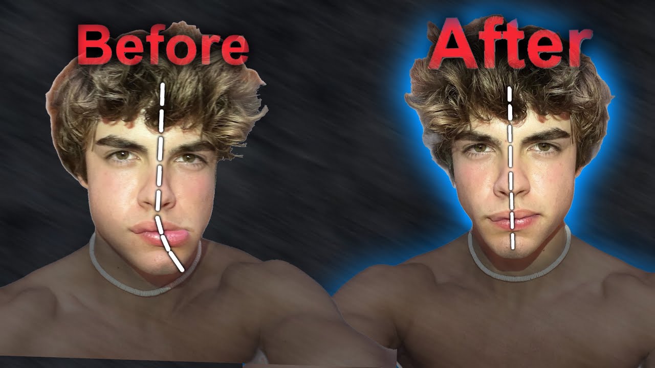 How To fix An Asymmetrical Face - YouTube