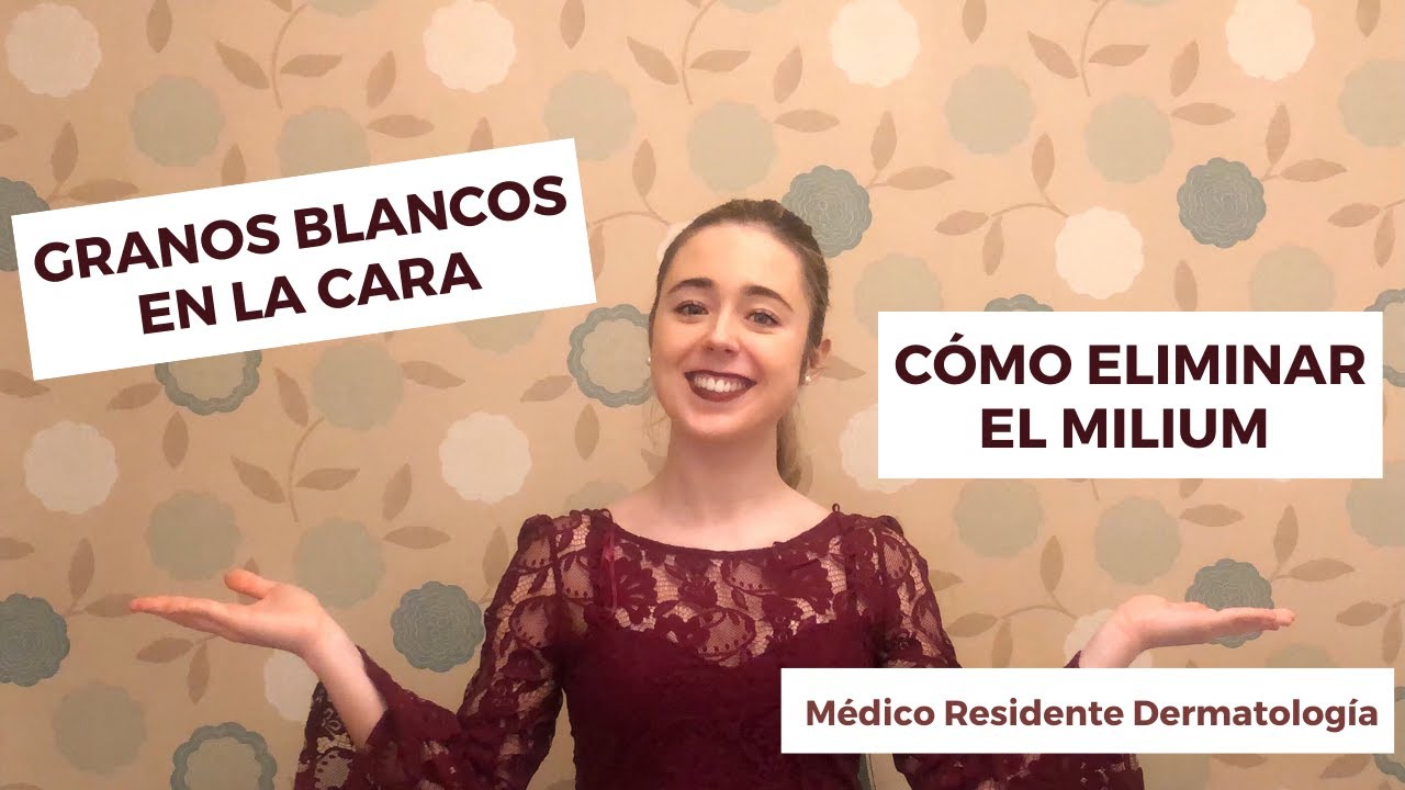 ¿GRANOS BLANCOS EN LA CARA? CÓMO ELIMINAR EL MILIUM | QUISTES DE ...