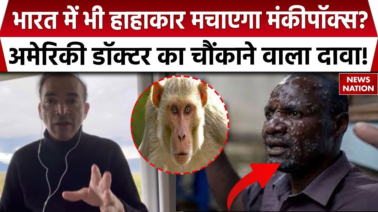 Monkey Pox: भारत में भी फैल सकता है मंकीपॉक्‍स? जानिए M-Pox क्या है और ...