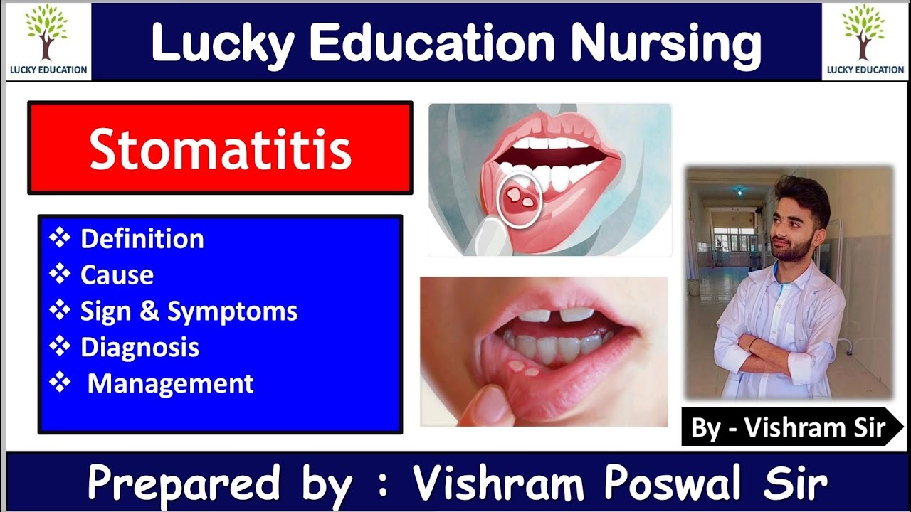 Stomatitis Cause Sign Symptoms, Diagnosis and Management G.I. Disorder ...