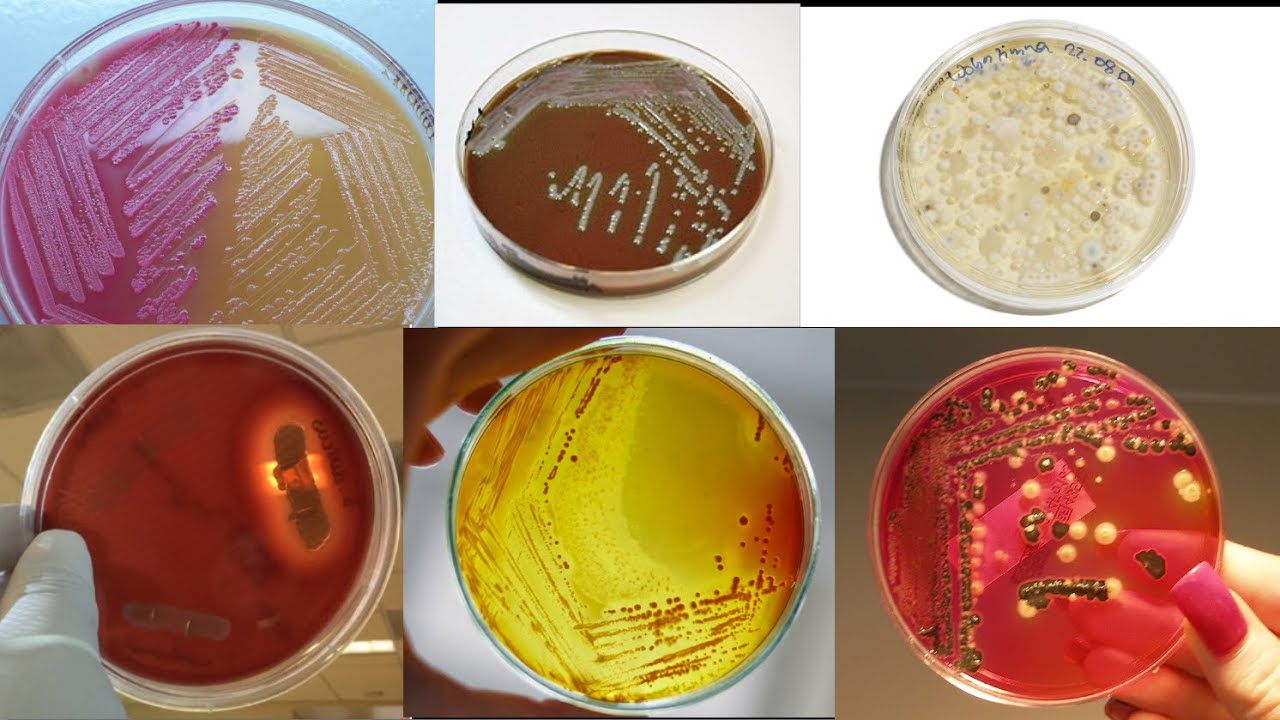 Microbiology Agar Plates