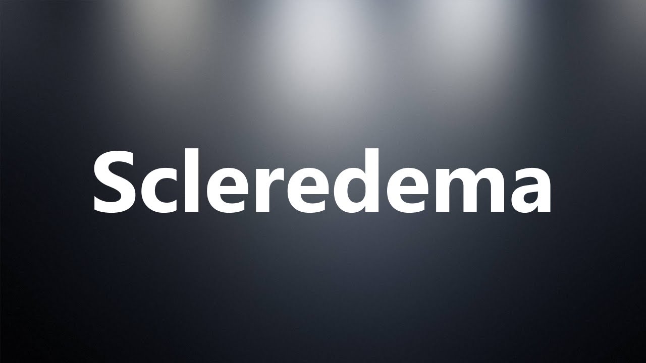 Scleredema - Medical Definition and Pronunciation - YouTube