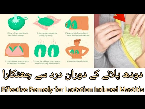 Cabbage Leaf Therapy for Lactating Mothers