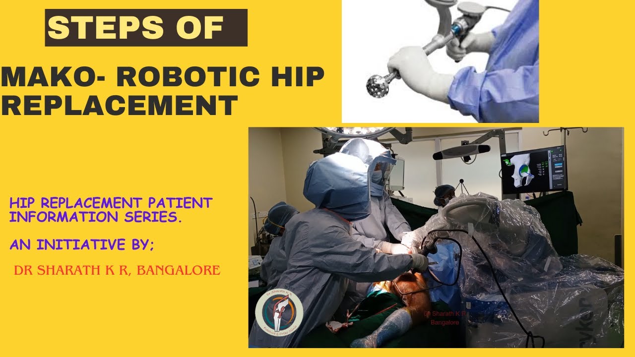 TOTAL HIP REPLACEMENT USING MAKO ROBOTIC SYSTEM - POSTERIOR APPROACH ...