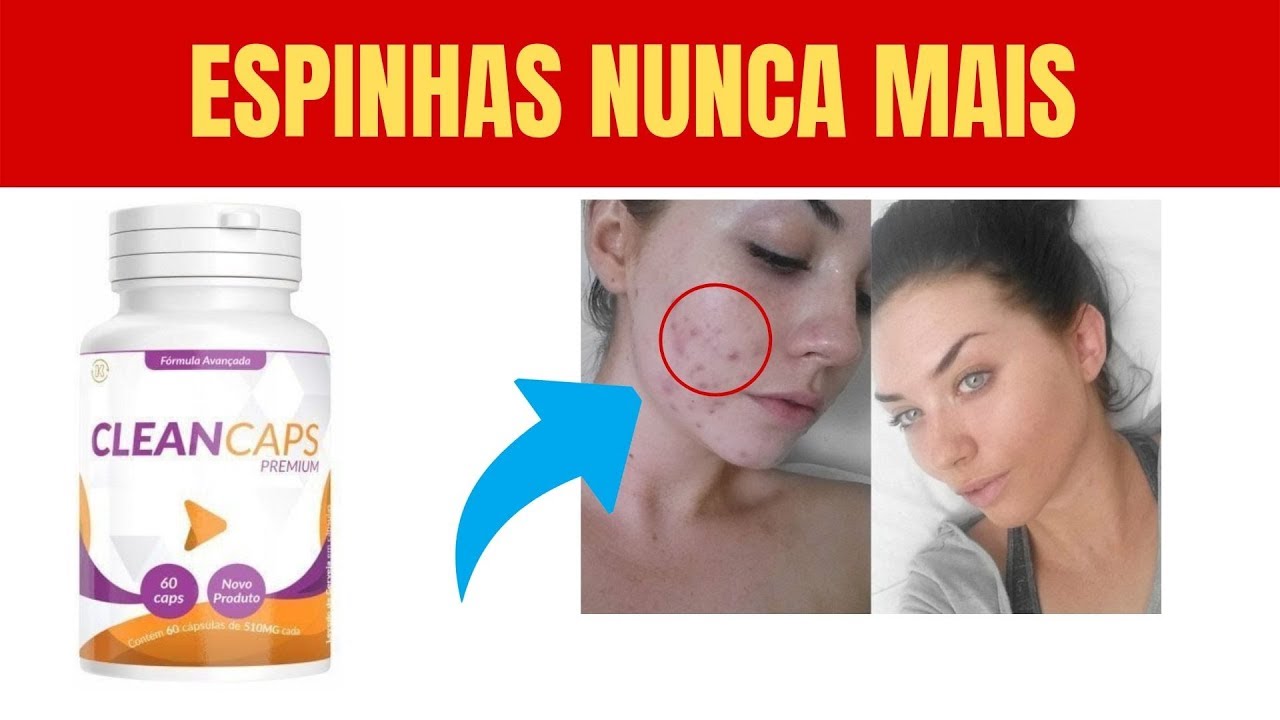 Clean Caps Funciona? Clean Caps Funciona Mesmo? Clean Caps Onde Comprar ...
