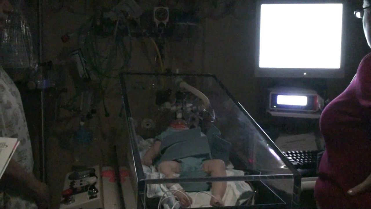 Infant Pulmonary Function test 14 - YouTube