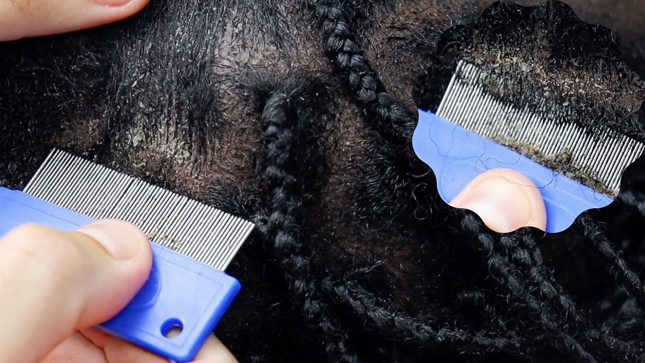 Deep Scratching & Picking Btn Braids with a lice comb ~ BEST TRIGGERS ...