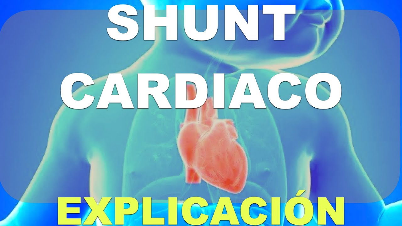 Cardiopatías. Cortocircuito o Shunt. - YouTube