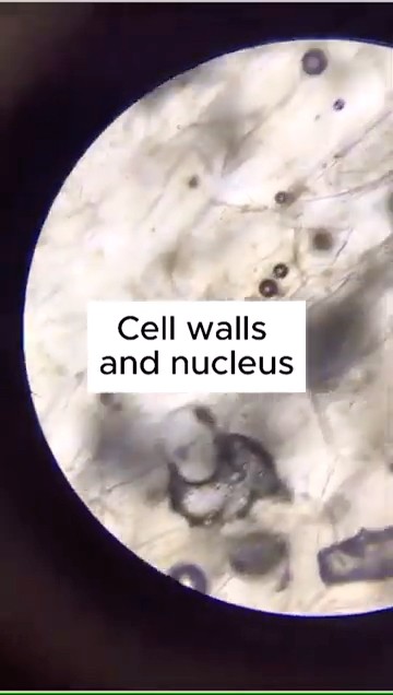 How does a fresh apple vs a rotten apple look like under the microscope ...