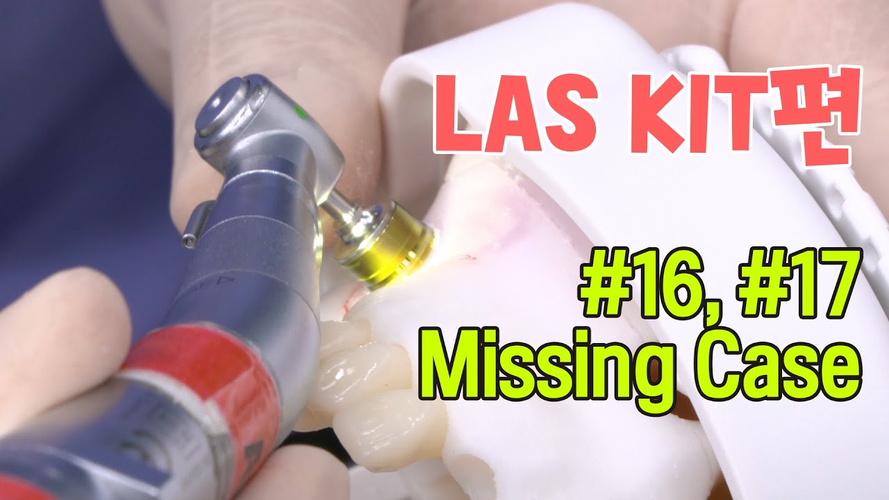 [LAS KIT] #16, #17 Missing Case - YouTube